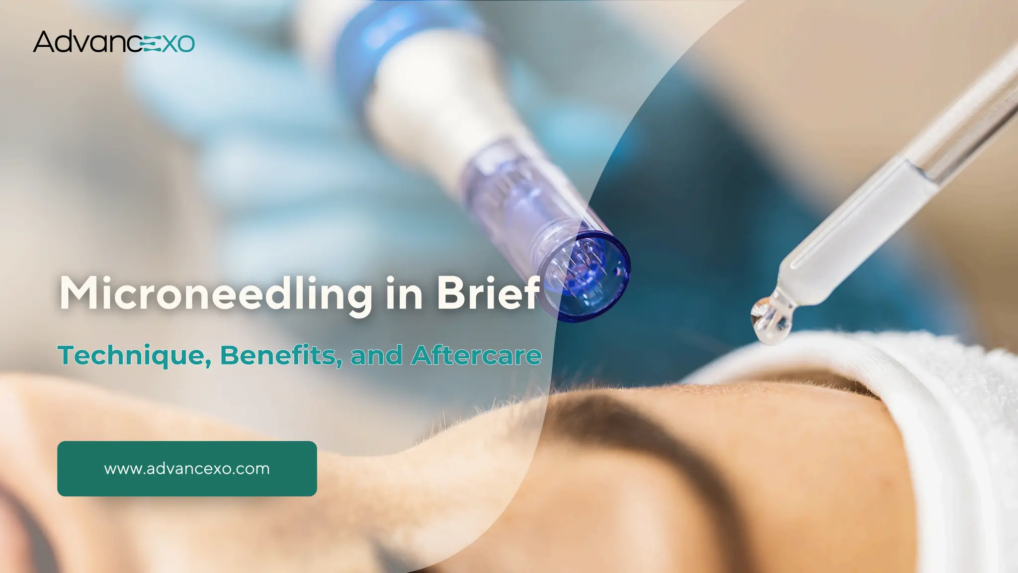 Microneedling in Brief: Technique, Benefits, and Aftercare | PDF
