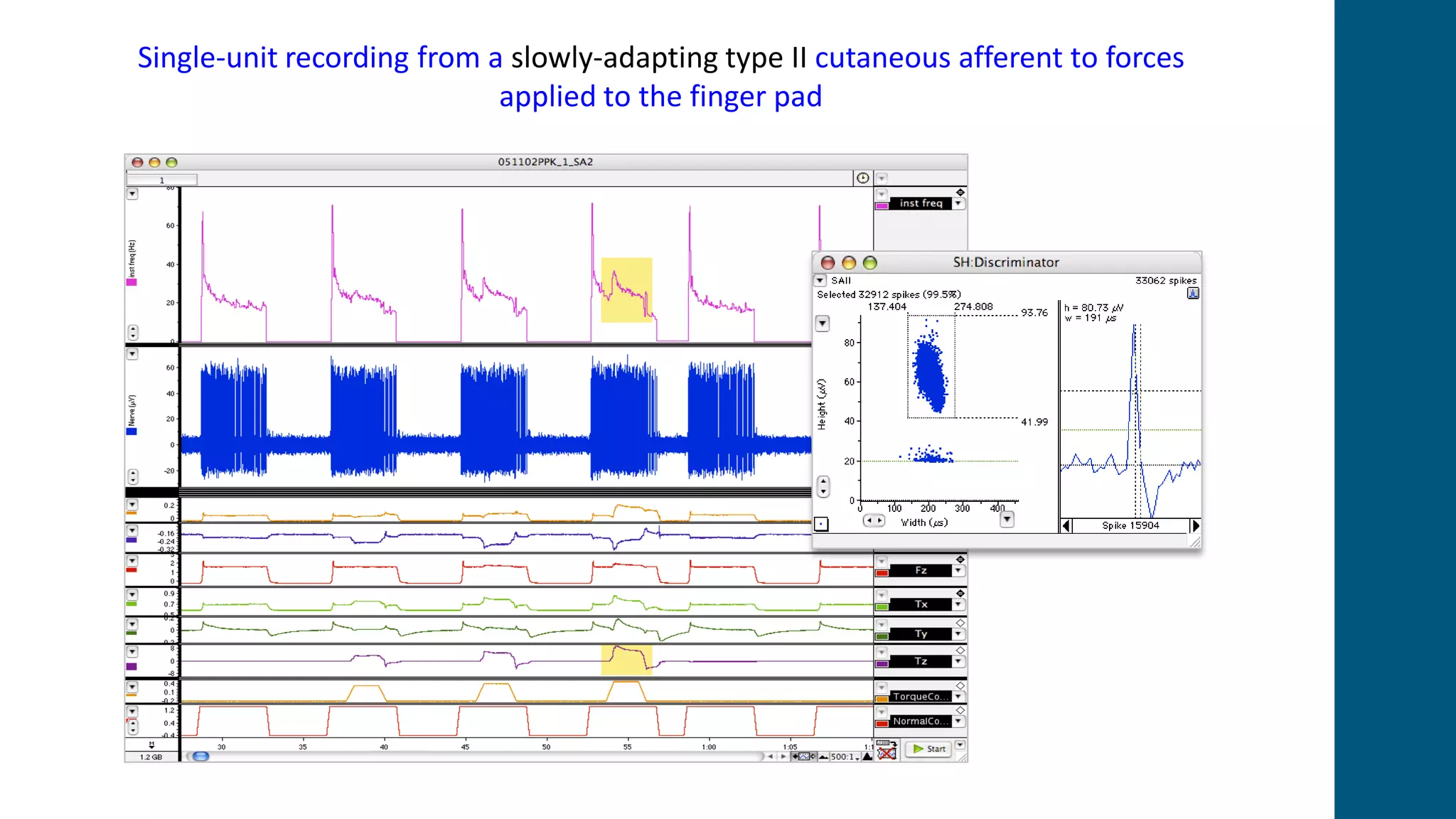 Microneurography: Recording Nerve Traffic Via Intraneural Microelectrodes in Awake Human ...