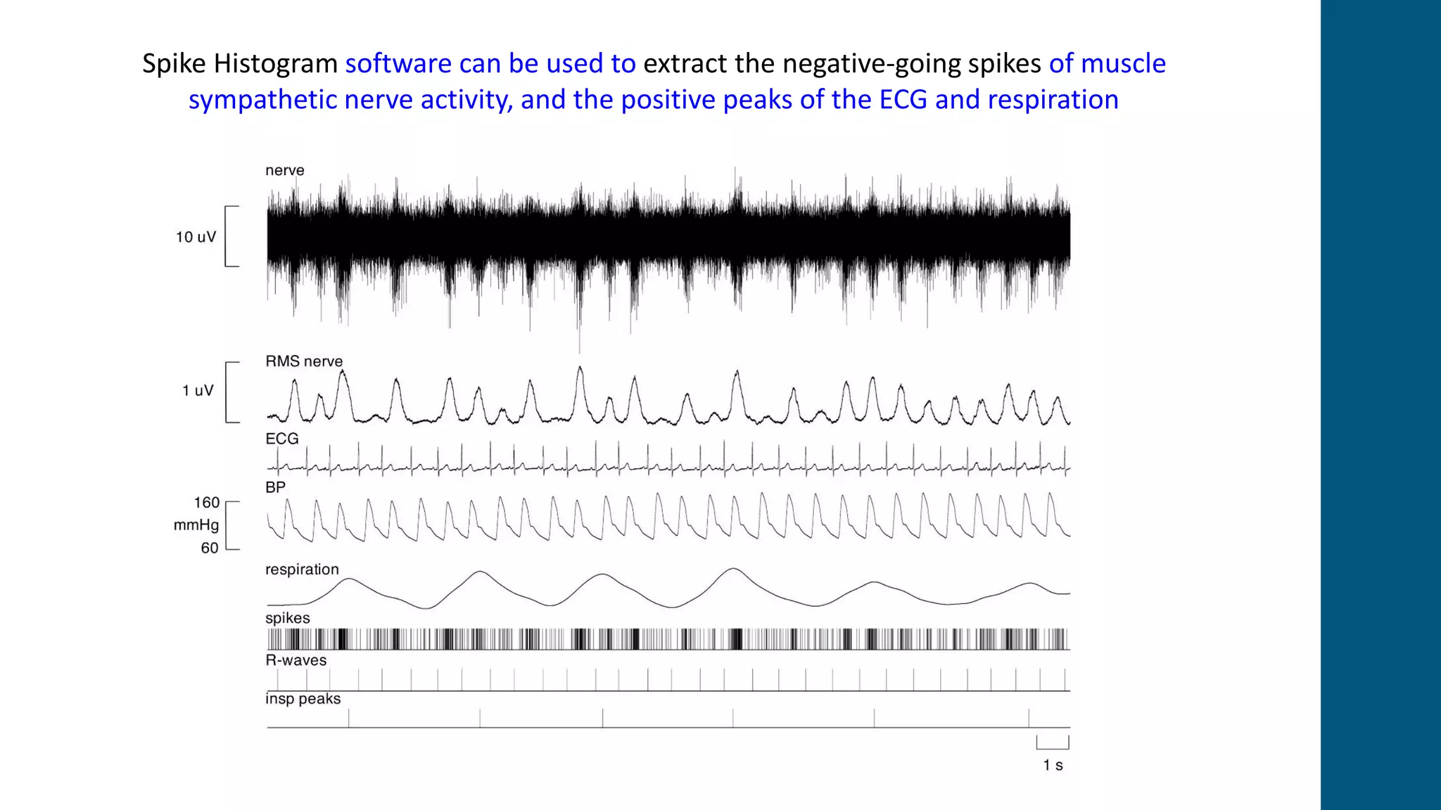 Microneurography: Recording Nerve Traffic Via Intraneural ...