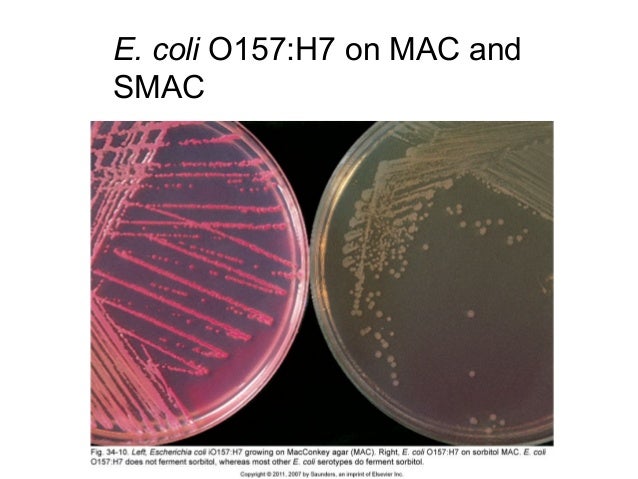 Micro notes gi_13_student