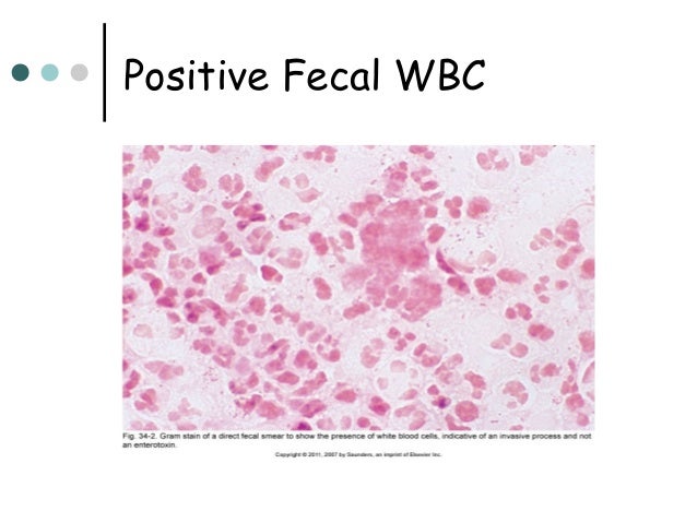 Micro notes gi_13_student