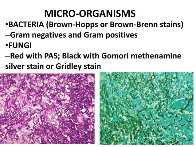 microorganism stain.pptx