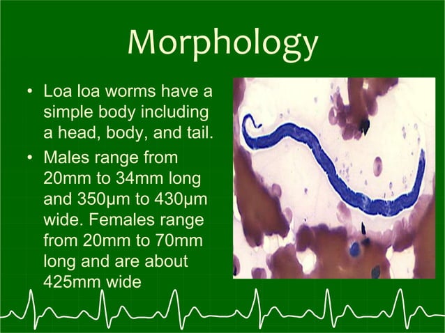 Loa-Loa in Microbiology & Parasitology | PPTX