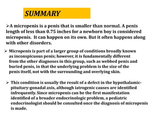 Micropenis in Children-Evaluation and Management | PDF