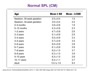 Micropenis in Children-Evaluation and Management | PDF
