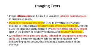 Micro phallus, Diagnosis and tretment.pptx