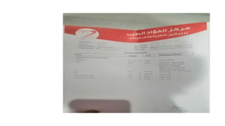 Micro phallus, Diagnosis and tretment.pptx