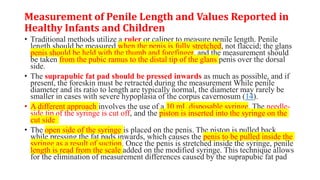 Micro phallus, Diagnosis and tretment.pptx