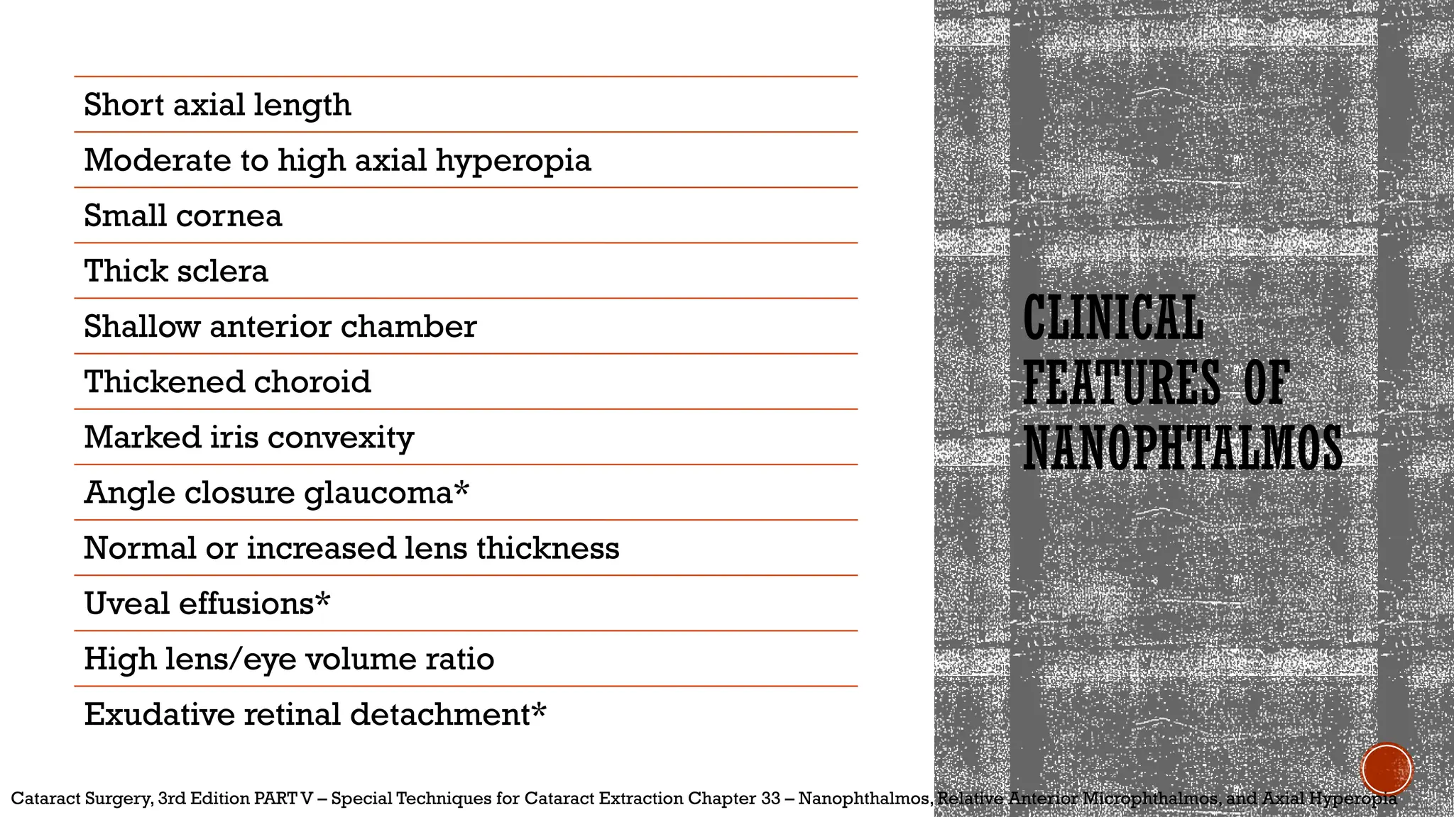 Microphtalmosvsnanophthalmosclinical .pptx