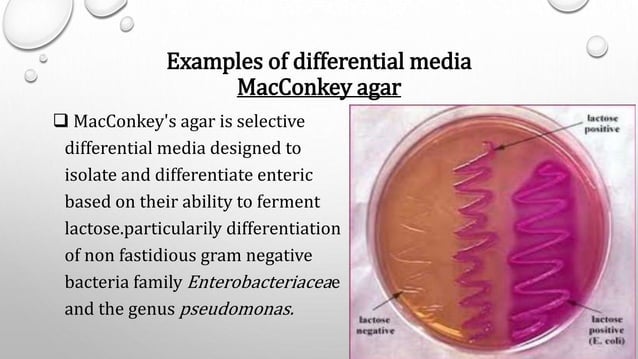 Bacterial Growth & culture media | PPTX