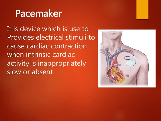 Microprocessor in human body | PPT