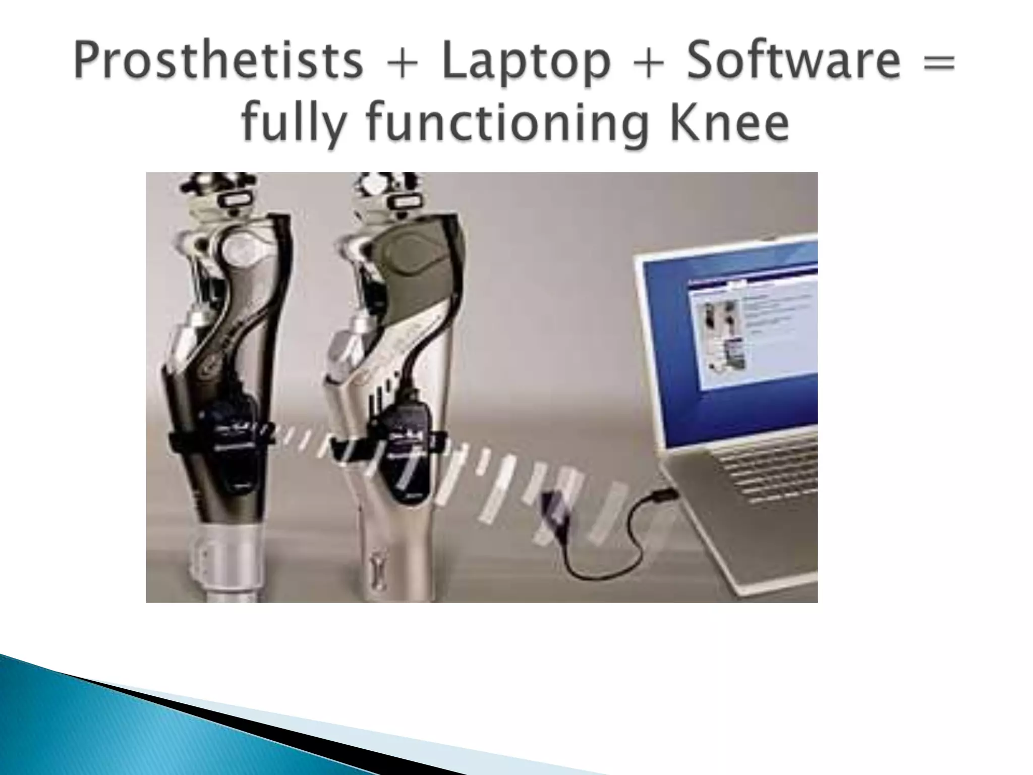 Microprocessor Prosthetic Knee Presentation | PPTX