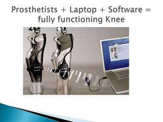 Microprocessor Prosthetic Knee Presentation | PPT