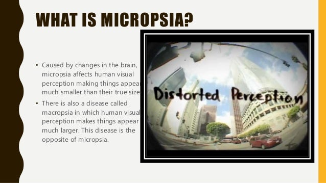 Micropsia