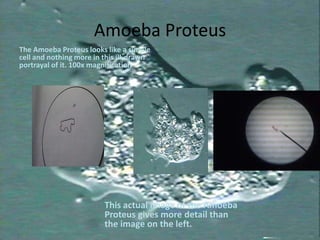 Amoeba Proteus Under Microscope 100x