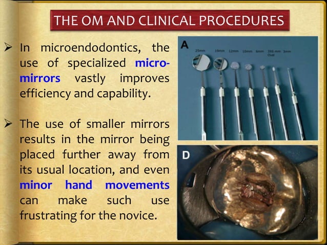 Operating Microscope in Endodontics | PPTX