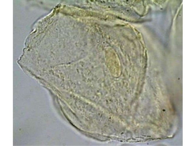 Microscope directions for Advanced Biology 9th grade | PPTX