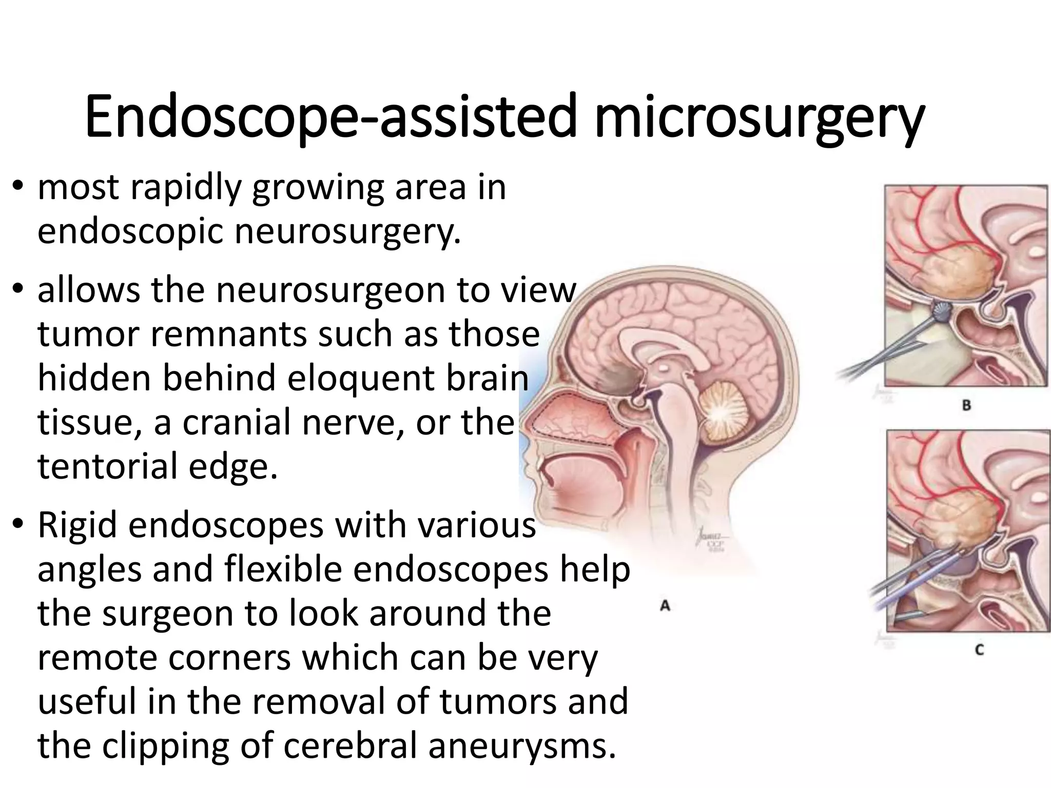Microscopes and Endoscopes in Neurosurgery.pptx