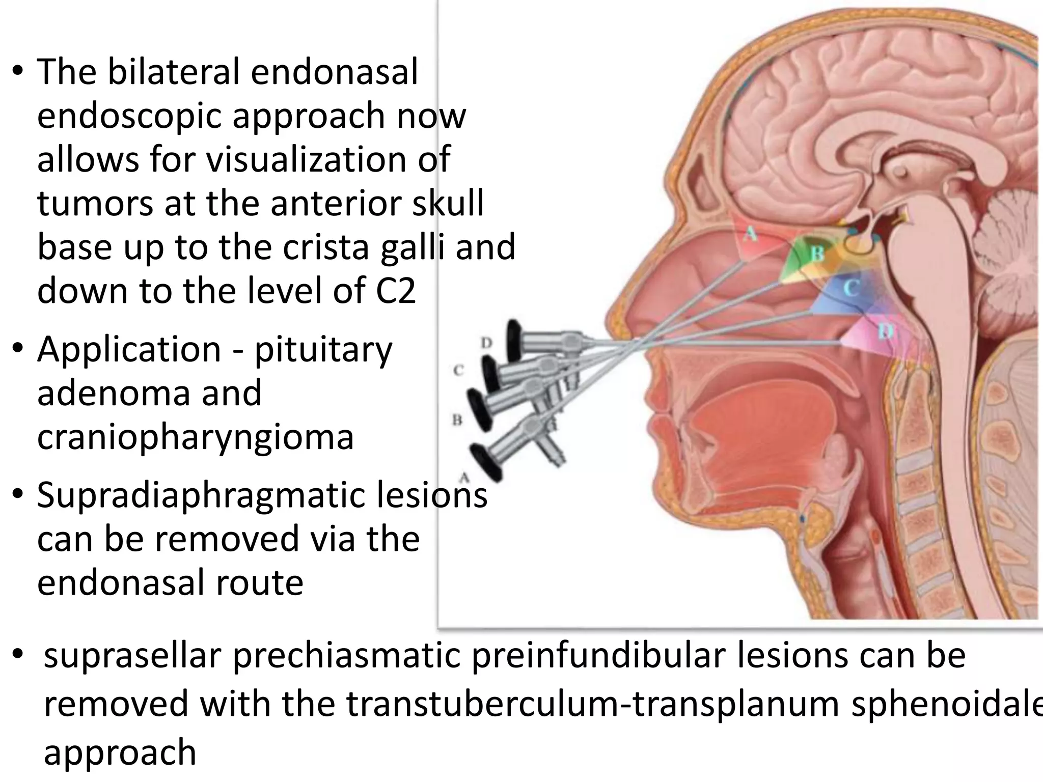 Microscopes and Endoscopes in Neurosurgery.pptx