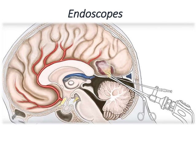 Microscopes and Endoscopes in Neurosurgery.pptx