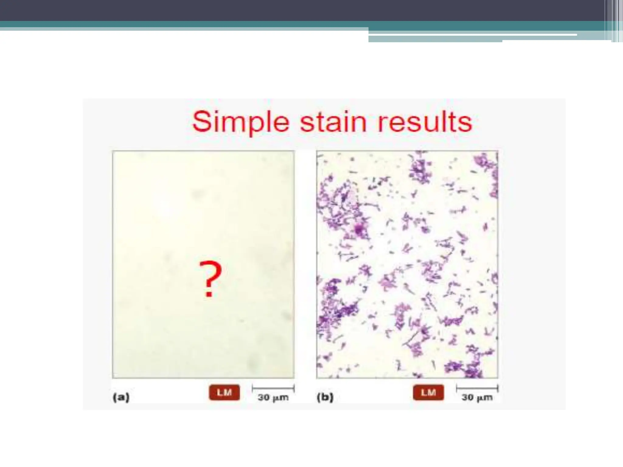 Microscopes & staining by DR C P PRINCE | PPTX