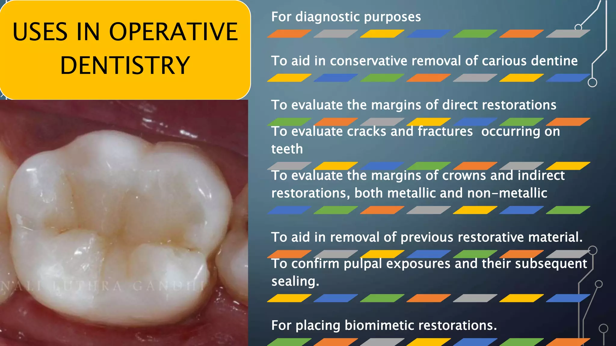 Microscopes in operative dentistry | PPTX