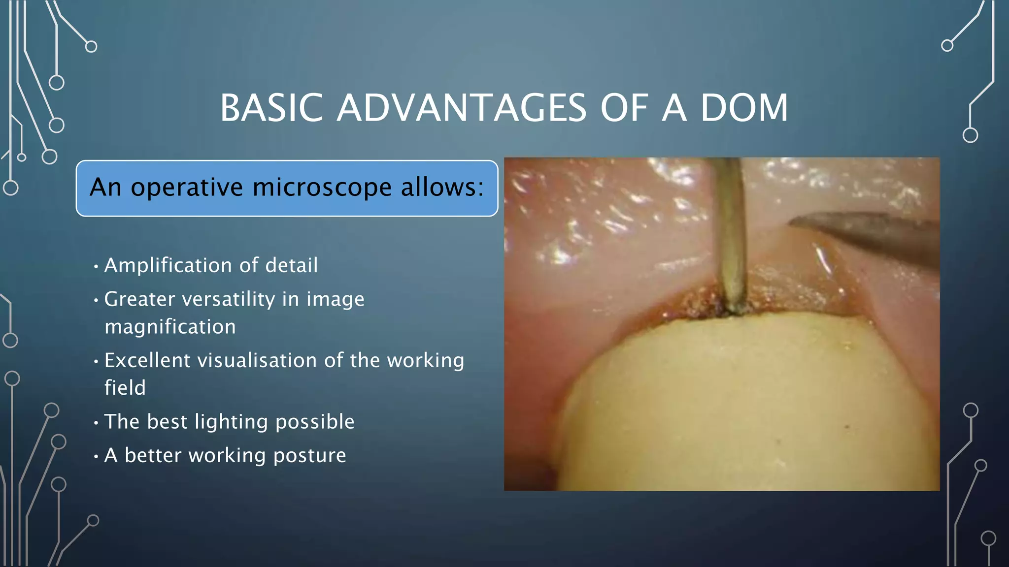 Microscopes in operative dentistry | PPTX