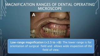 Microscopes in operative dentistry | PPTX