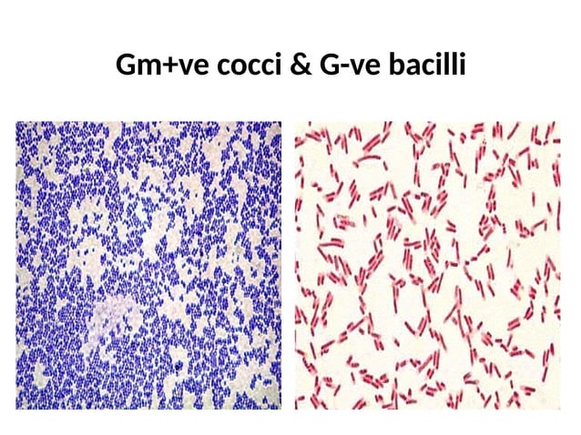 microscope & staining methods for bacterial visualization | PPTX