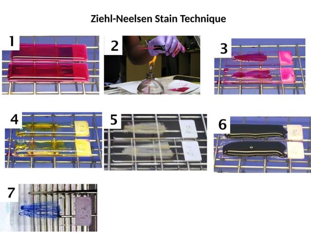 microscope & staining methods for bacterial visualization | PPTX