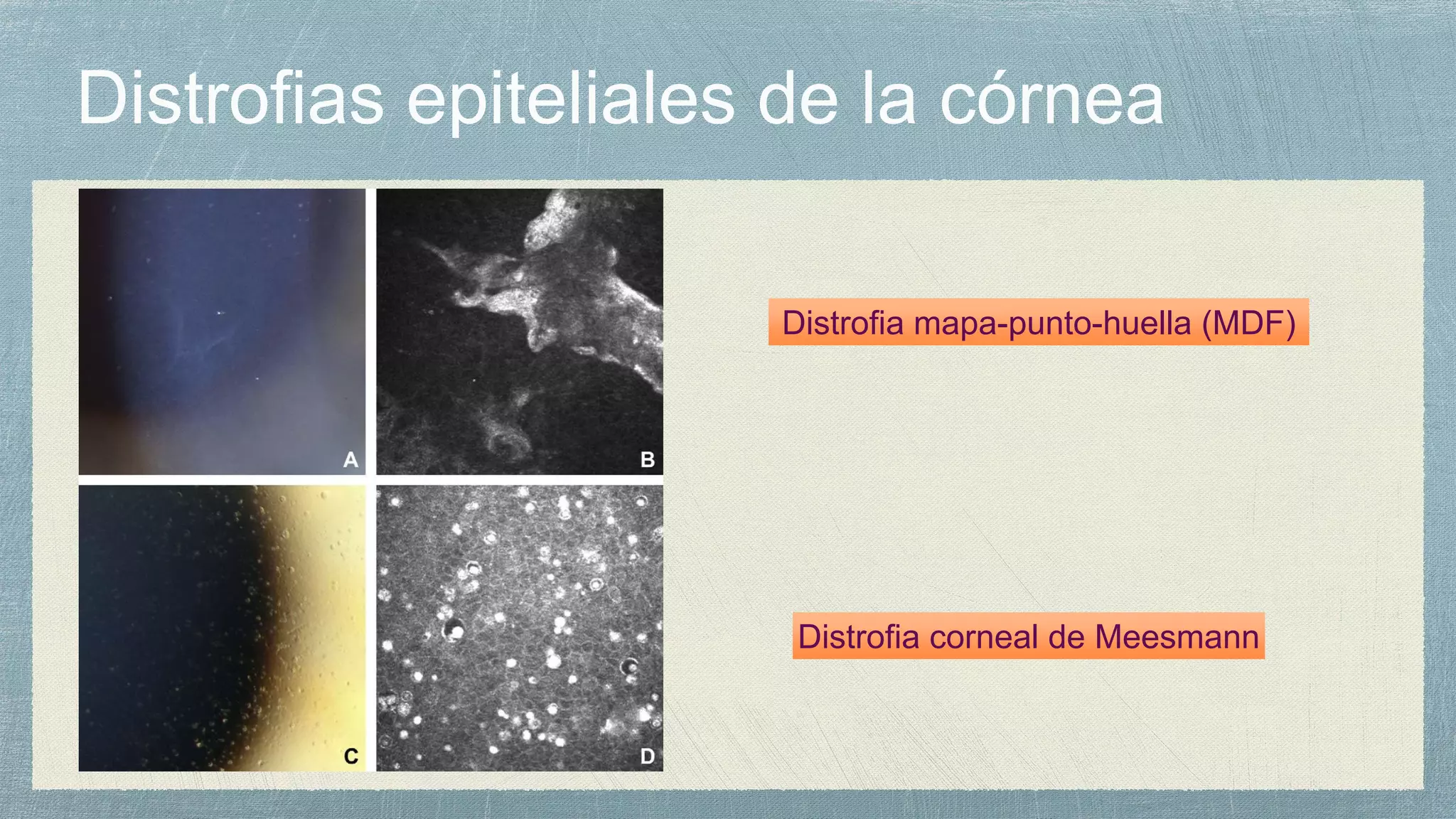 MICROSCOPÍA CONFOCAL | PPT