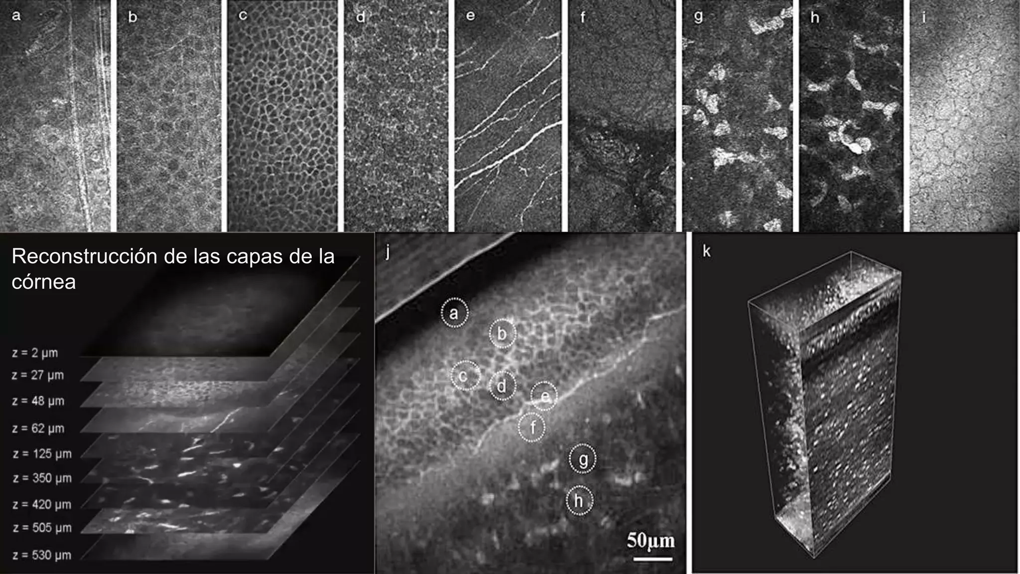 MICROSCOPÍA CONFOCAL | PPT