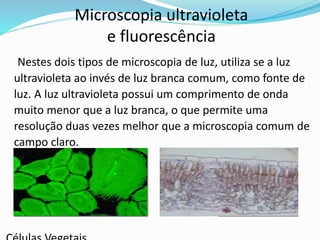 Microscopia de ultravioleta e fluorescência | PPTX