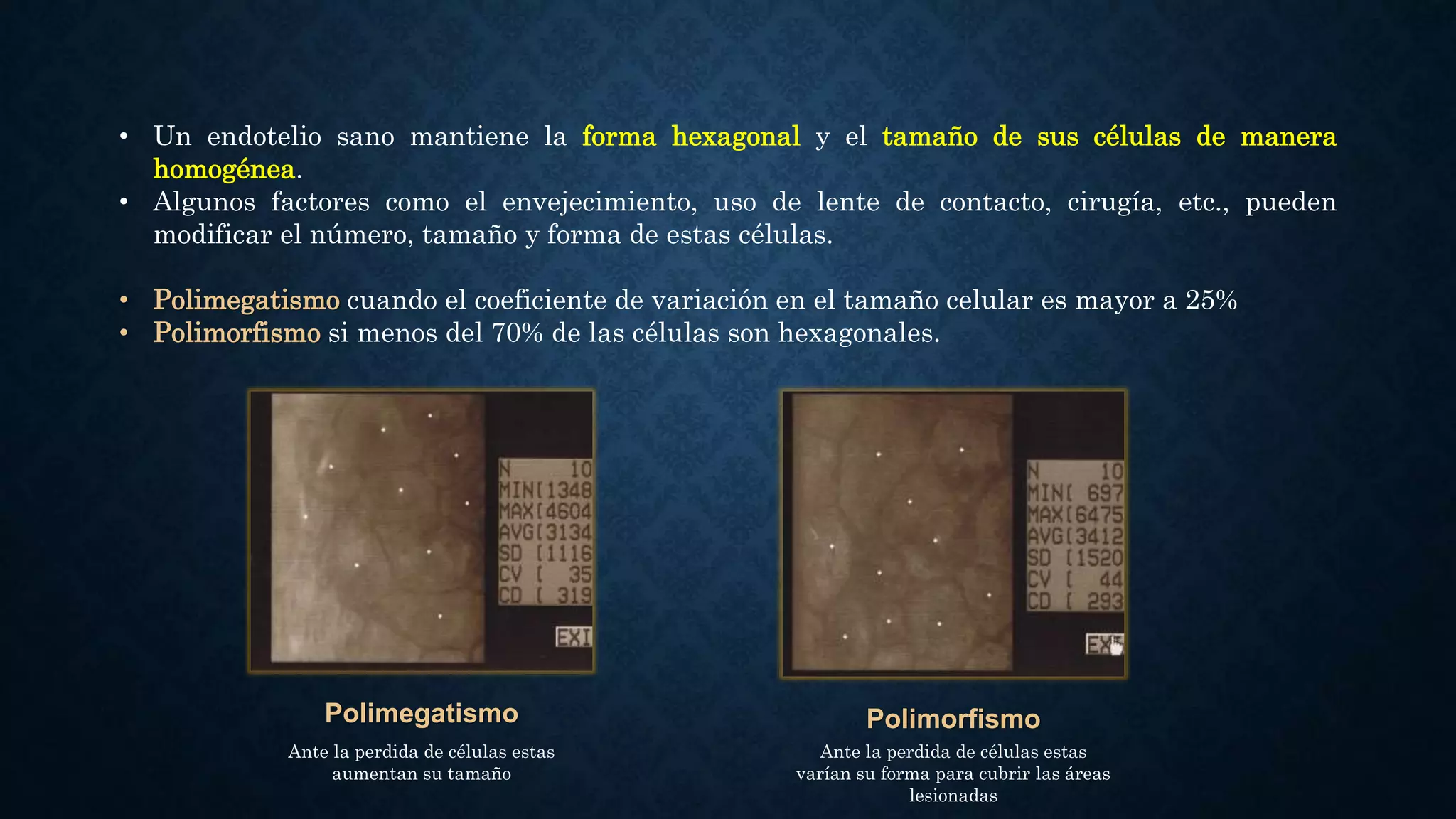 Microscopia especular SF Cjara | PPTX | Eye and Vision Conditions ...