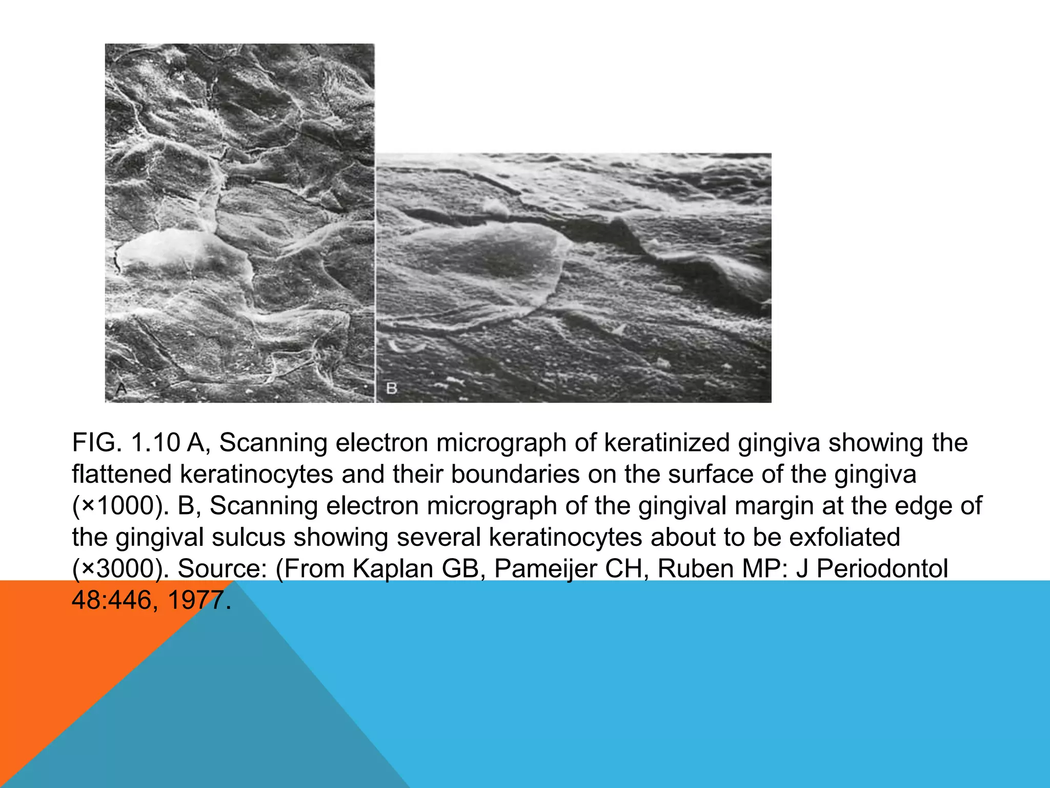 Microscopic anatomy of gingival epithelium | PPTX
