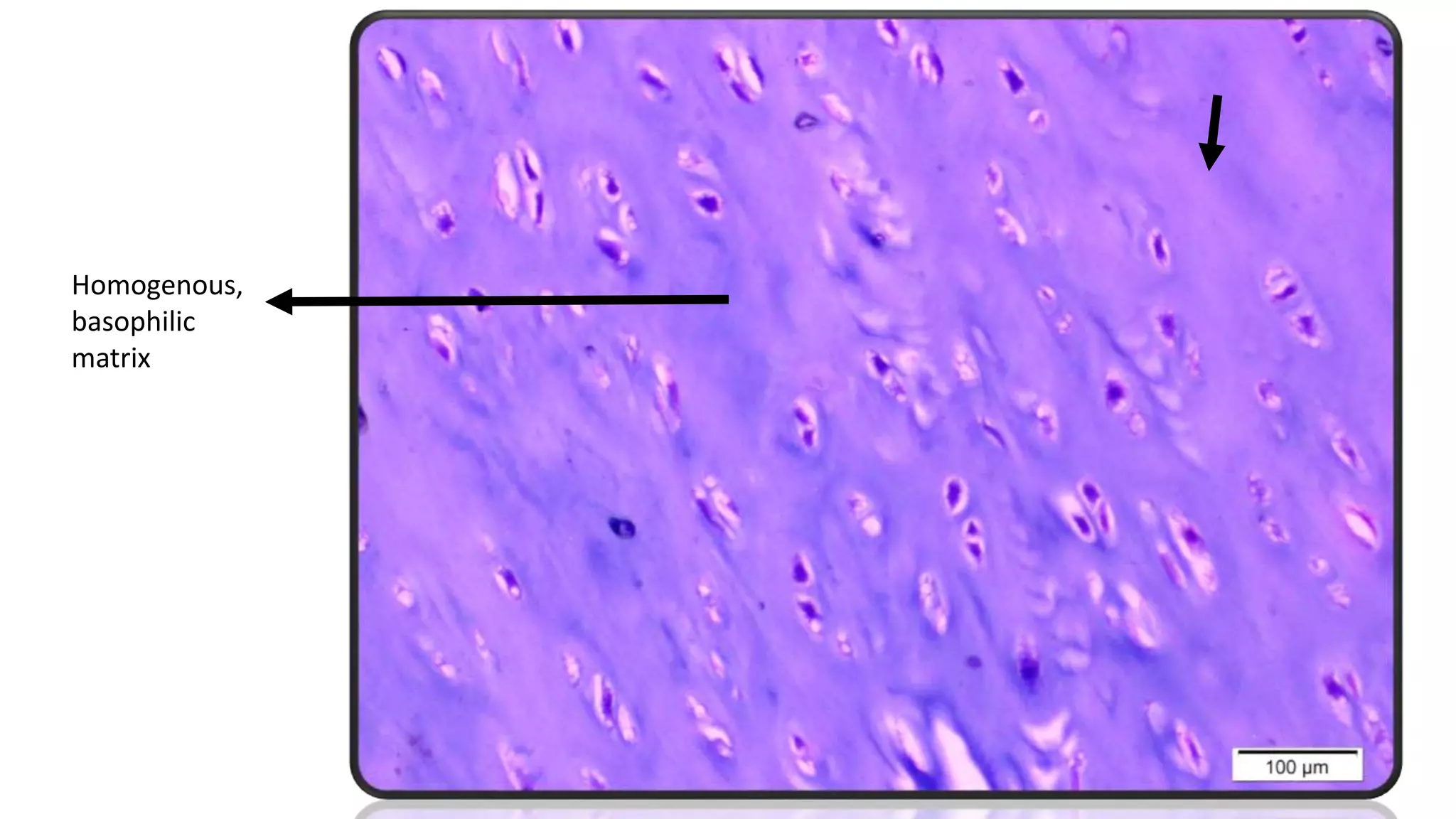 Microscopic anatomy of Hyaline cartilage | PPTX