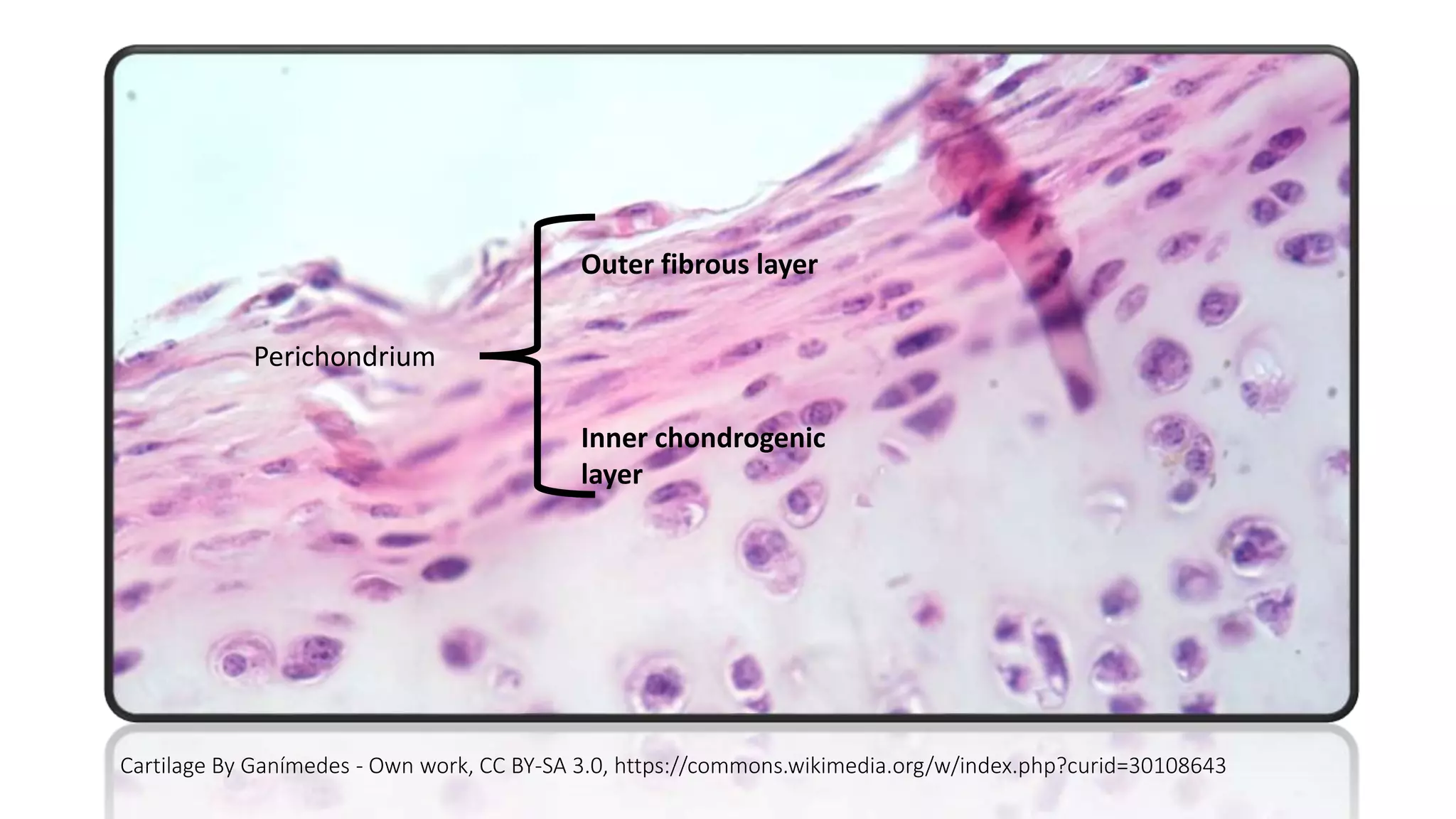 Microscopic anatomy of Hyaline cartilage | PPTX
