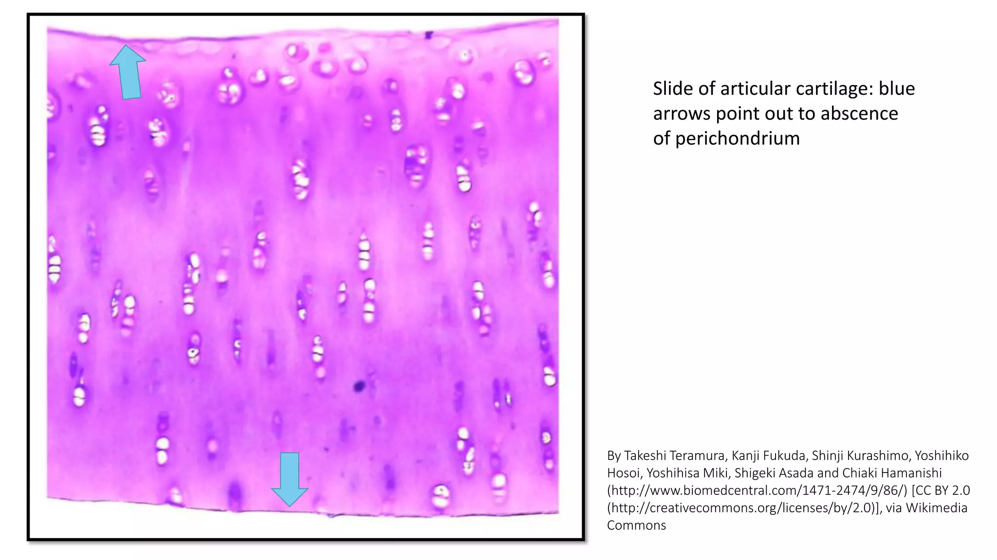 Microscopic anatomy of Hyaline cartilage | PPTX