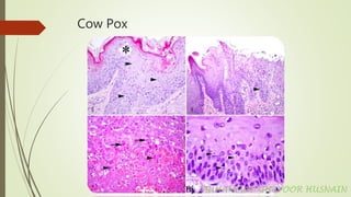 Microscopic examination of blood by MUHAMMAD ASHIR | PPTX