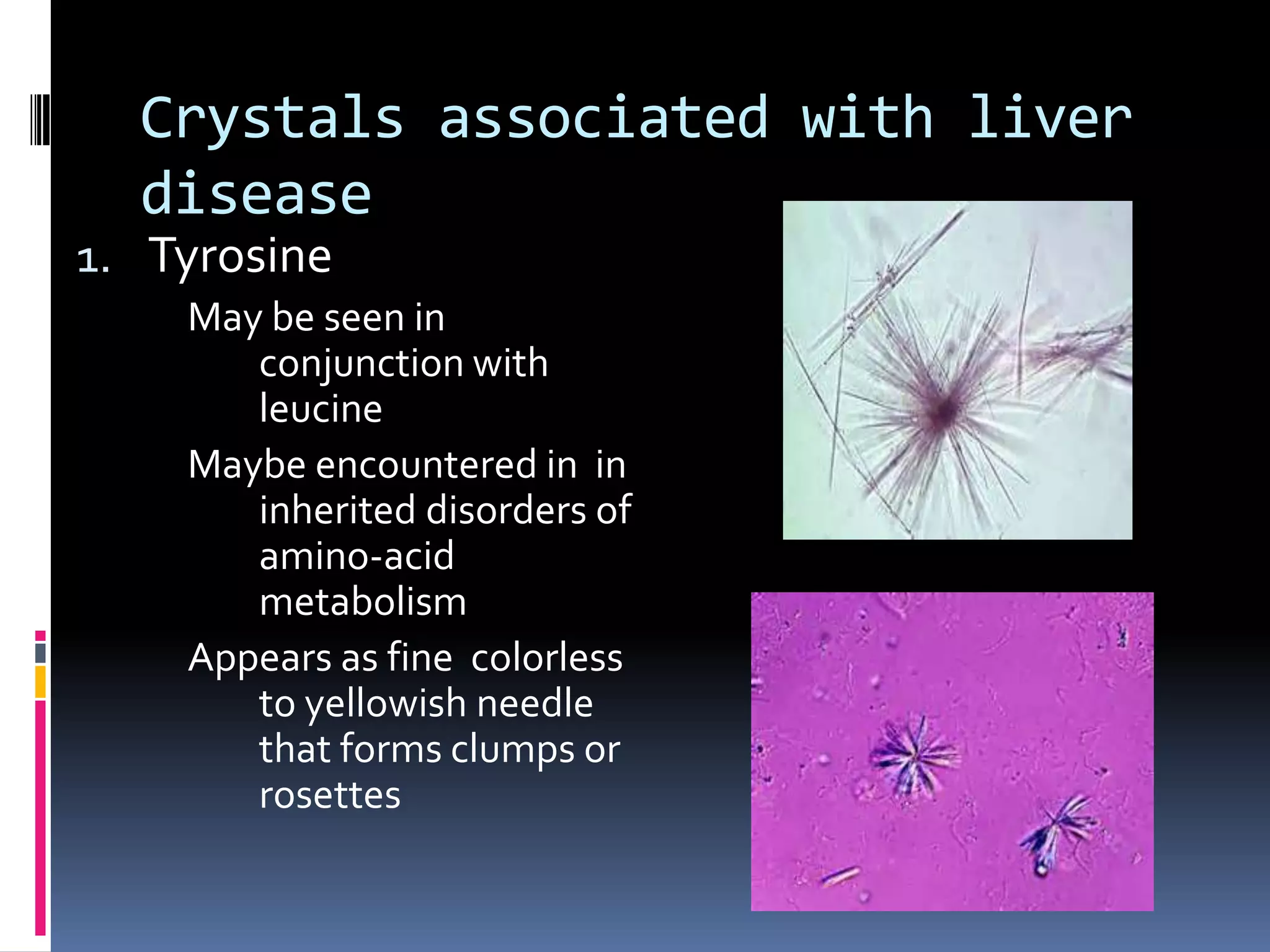 Microscopic examination of urinary sediments | PPTX | Chemistry | Science