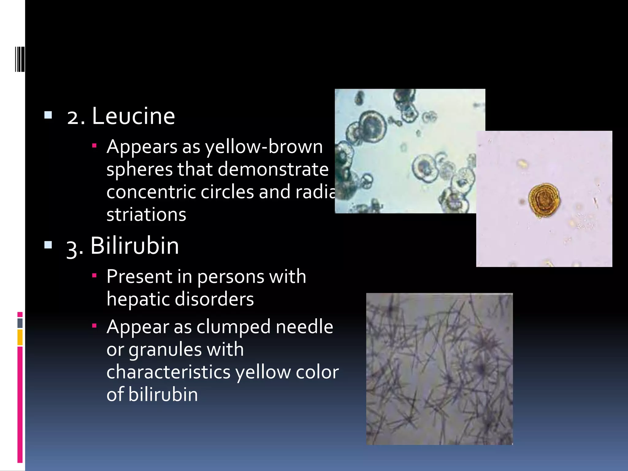 Microscopic examination of urinary sediments | PPTX