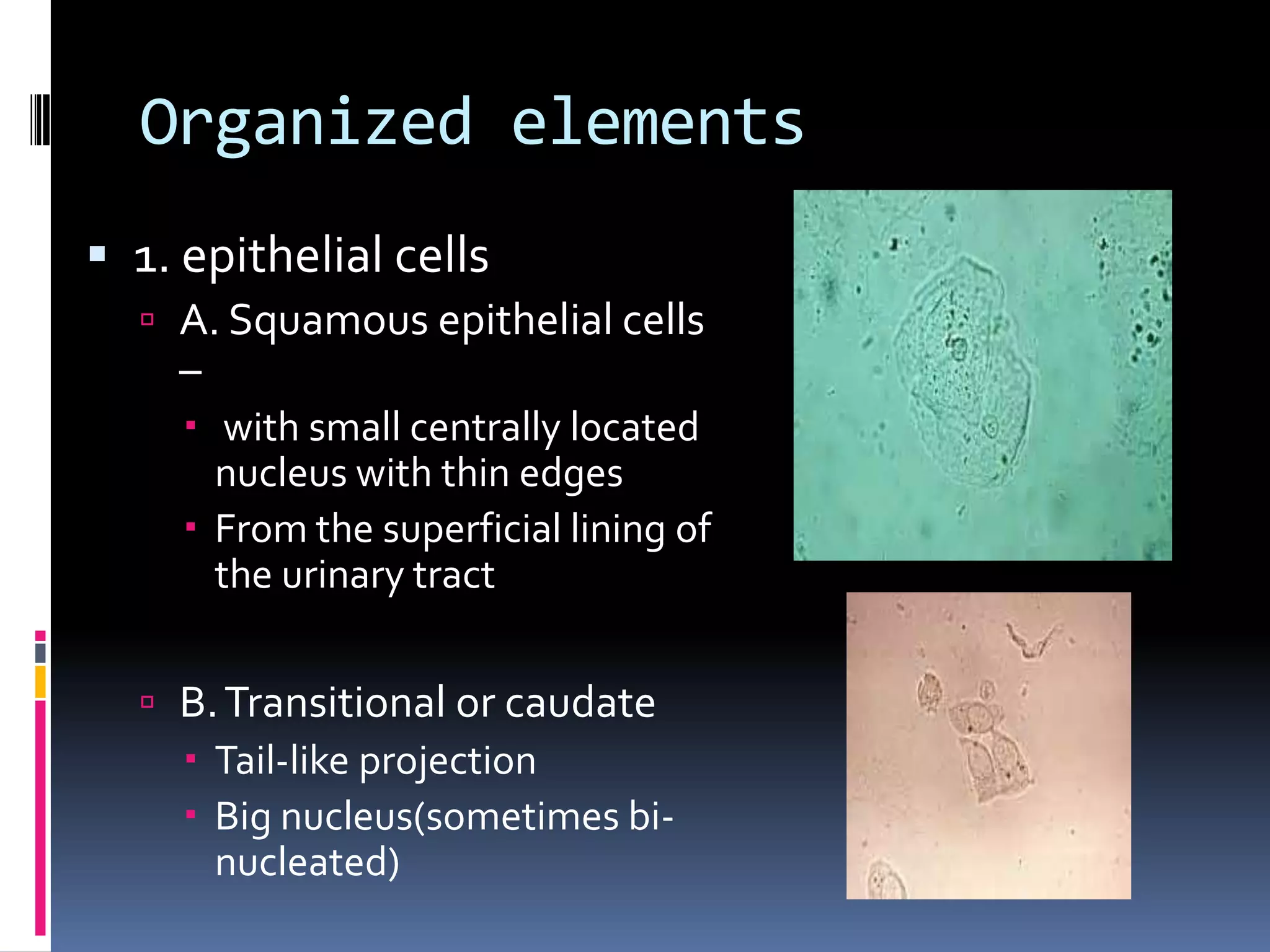Microscopic examination of urinary sediments | PPTX | Chemistry | Science
