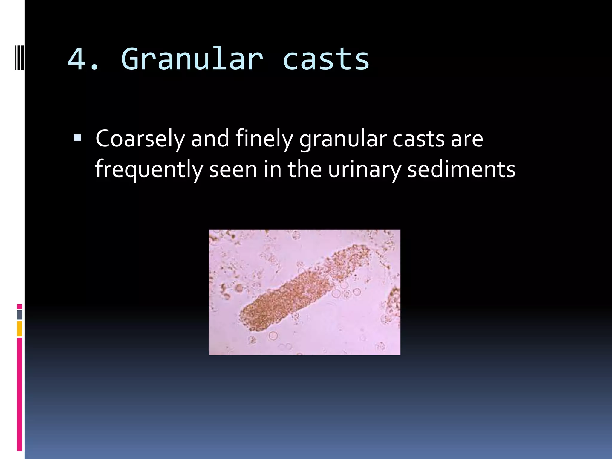 Microscopic examination of urinary sediments | PPTX