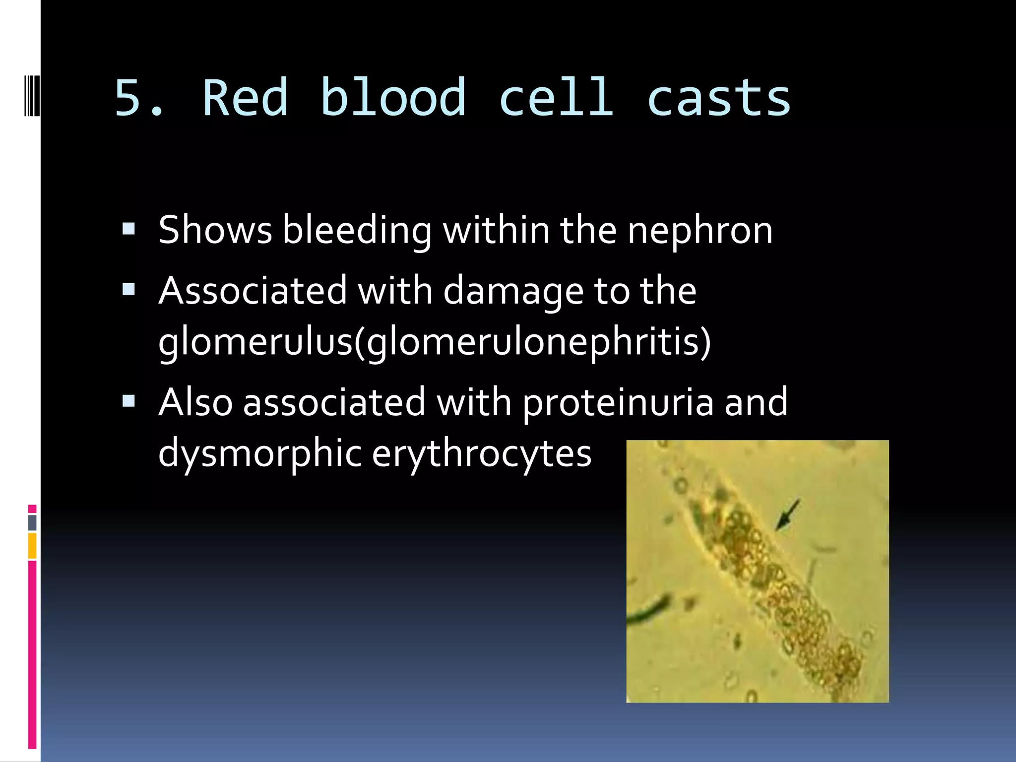 Microscopic examination of urinary sediments | PPTX