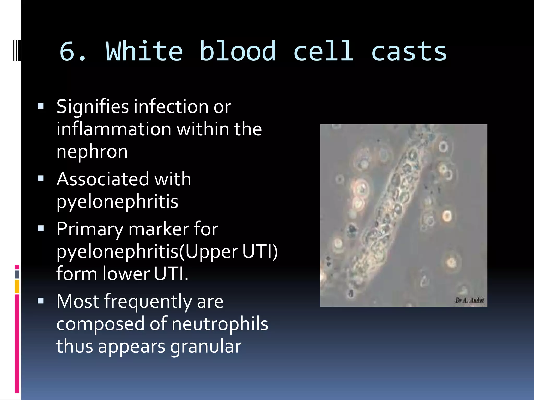 Microscopic examination of urinary sediments | PPTX