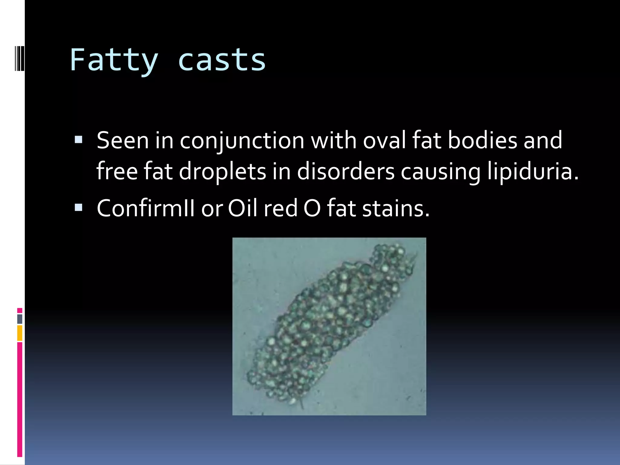 Microscopic examination of urinary sediments | PPTX