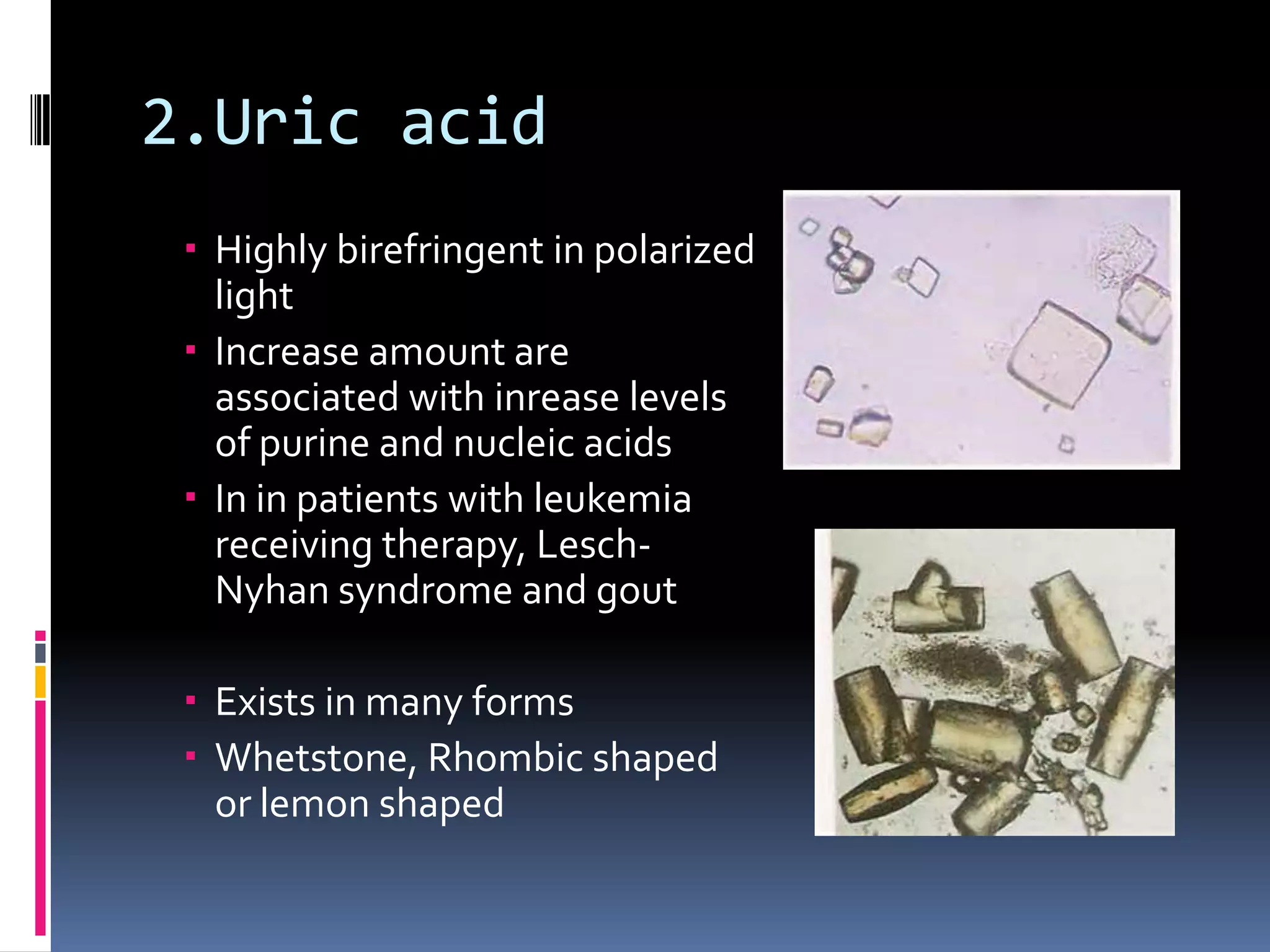 Microscopic examination of urinary sediments | PPTX