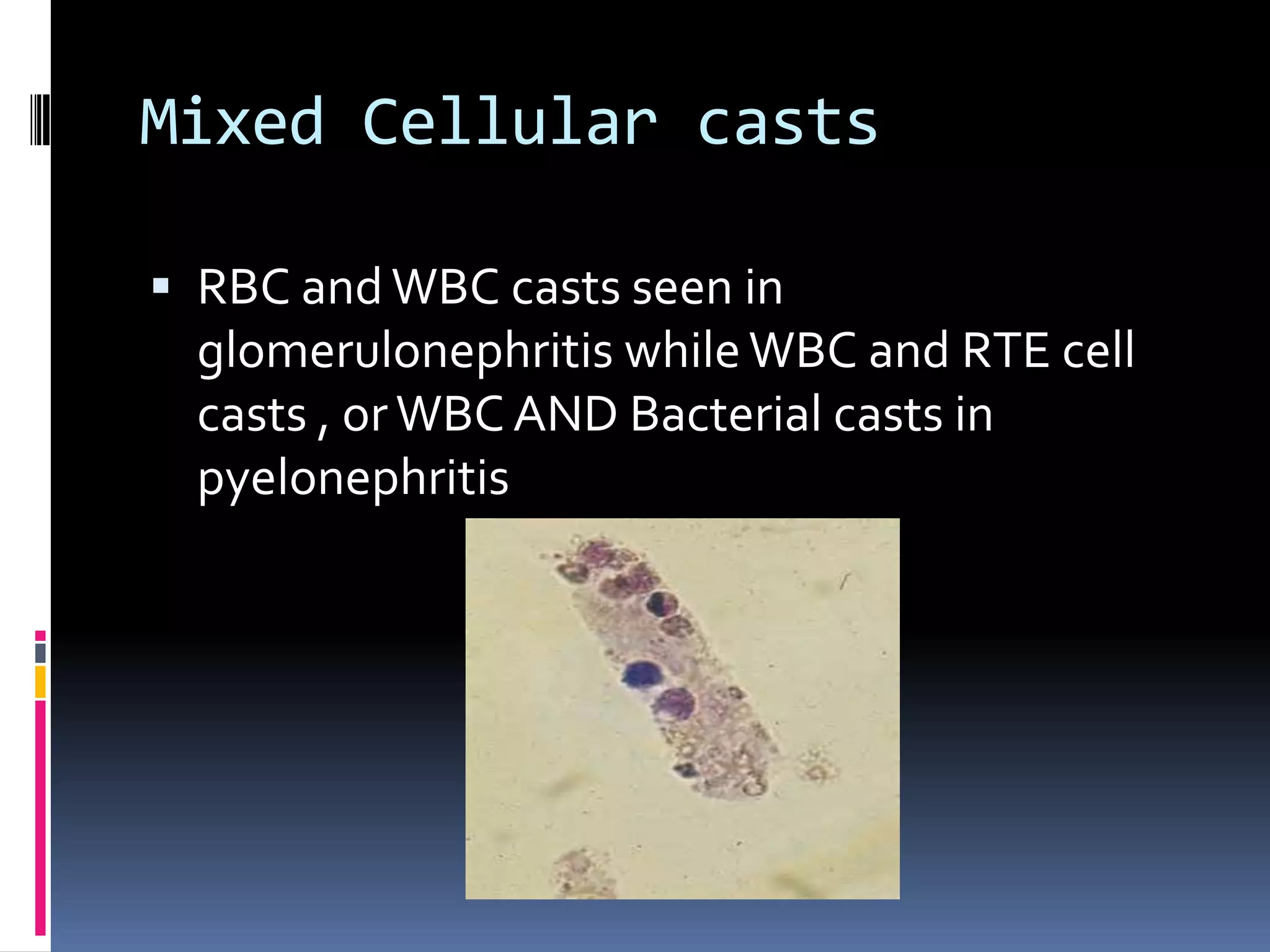 Microscopic examination of urinary sediments | PPTX