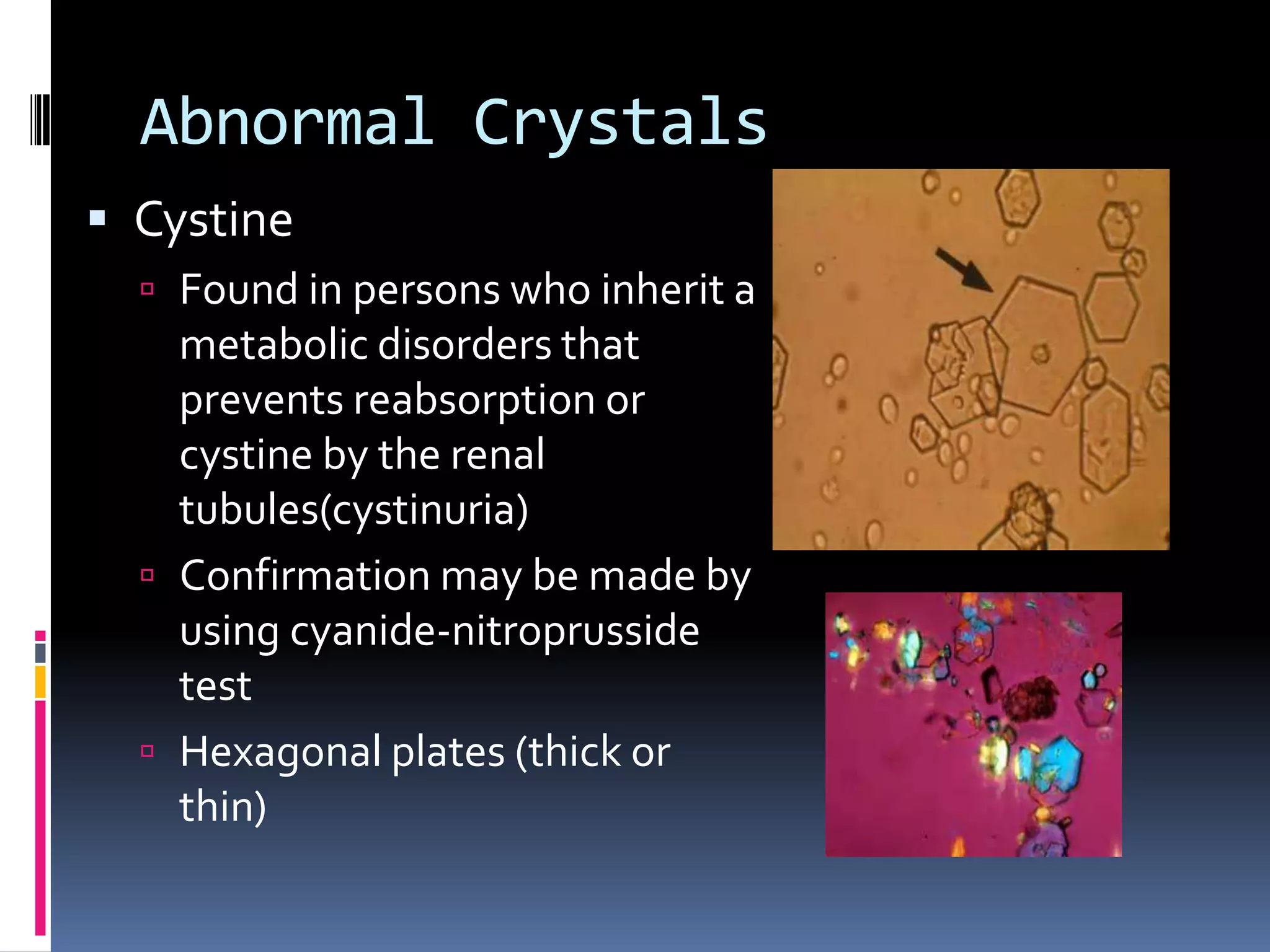 Microscopic examination of urinary sediments | PPTX