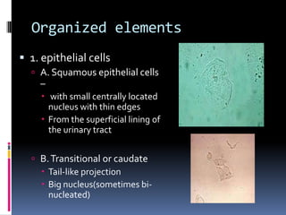 Microscopic examination of urinary sediments | PPTX